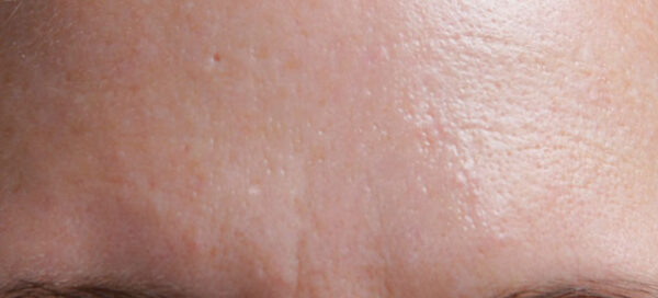 How SilcSkin Works - SilcSkin