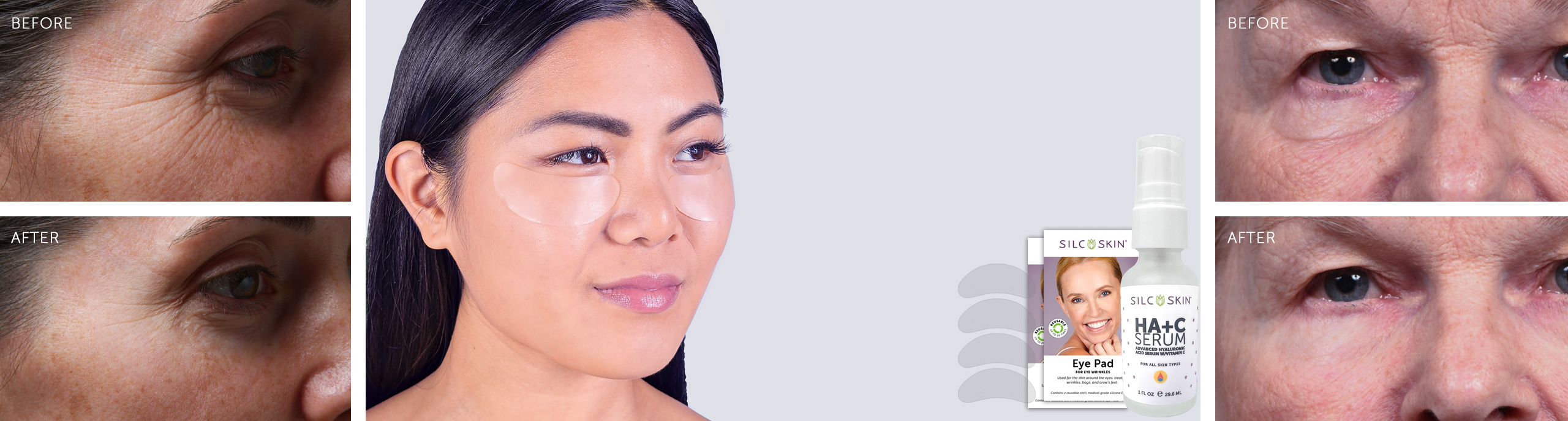 Wrinkle Treatments and Decollette Pads - Non-Invasive Solutions for ...